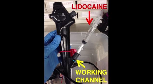 Fiberoptic Intubation- Devices – EM in 5