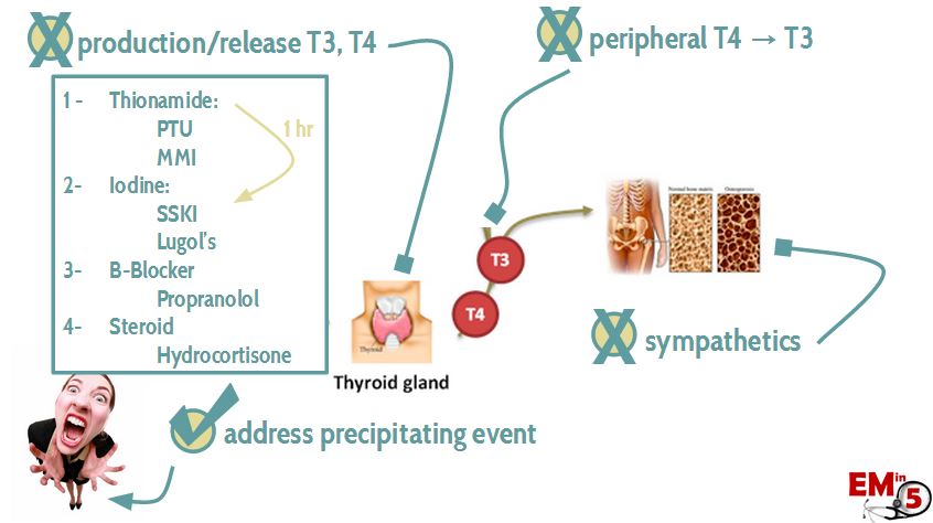 Thyroid Storm – EM in 5