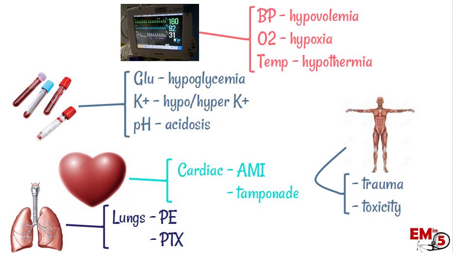 H’s and T’s of Cardiac Arrest – EM in 5